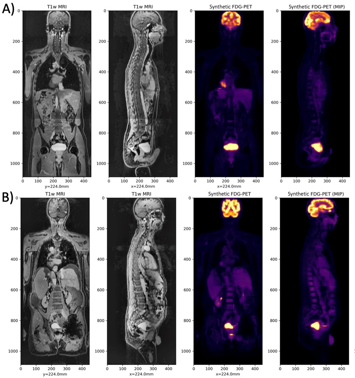 Multi-Institutional Team Develops Deep Learning Technique for ...